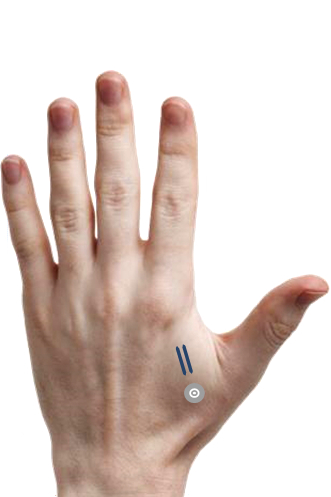 Chip Implant Guide - I am ROBOT - NFC Implantate online manual